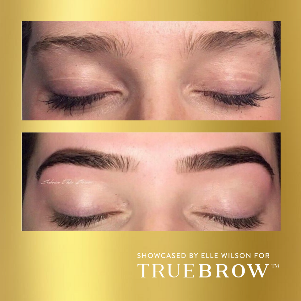 The Most Drastic Truebrow™ Transformations of All Time - TrueBrow™